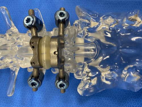 Treatment of Degenerative Conditions of the Lumbar Spine: How the Total ...