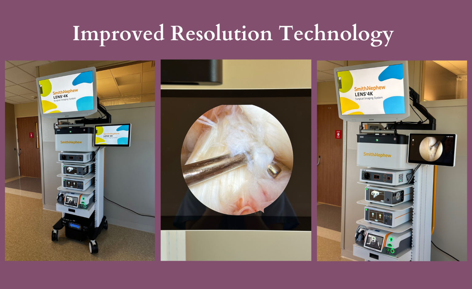 OHOW Updates Surgical Technology: Enhancing Precision and Improving ...